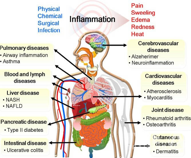 Inflammation Health Effects: Understanding The Body's Response