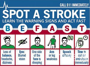 Stroke And Exercise For Seniors: A Comprehensive Guide